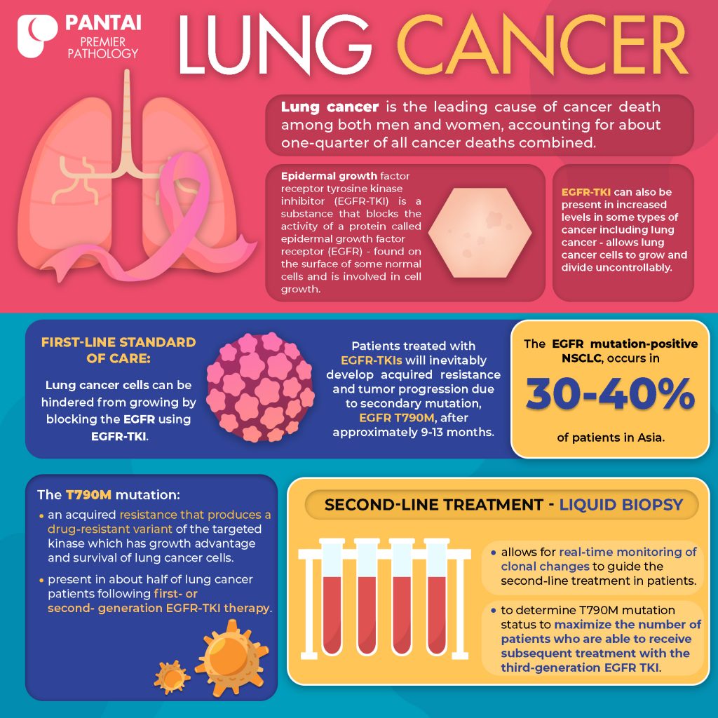 Liquid biopsy for detection of EGFR T790M mutation in Non-Small Cell Lung Cancer (NSCLC ...